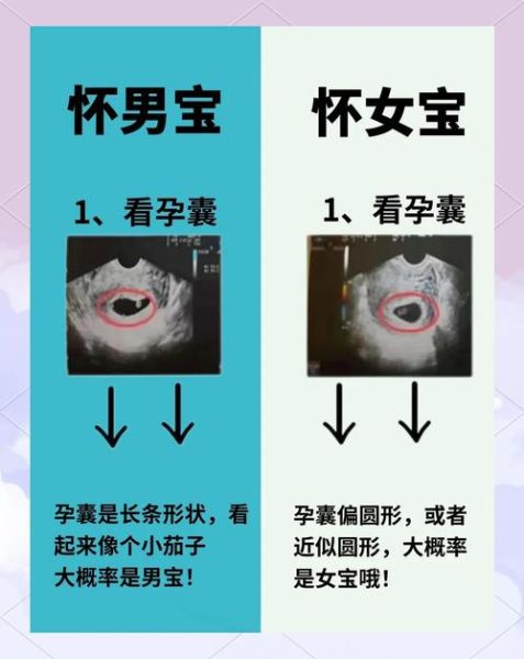 孕初期一招看男女是真的吗_孕早期怎么判断男女-第1张图片-山城妙识
