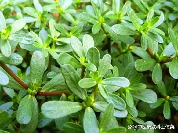 马齿苋治疗白斑有效吗_马齿苋治白斑成功案例-第2张图片-山城妙识 马齿苋治疗白斑有效吗_马齿苋治白斑成功案例-第2张图片-山城妙识