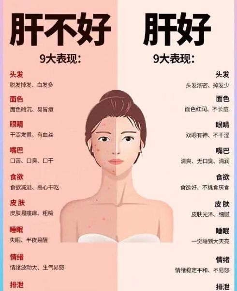 男性肝脏不好的4个表现_怎么调理-第2张图片-山城妙识 男性肝脏不好的4个表现_怎么调理-第2张图片-山城妙识