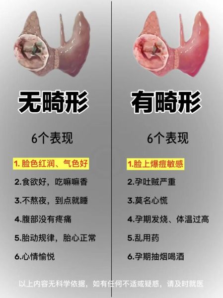 胎儿畸形几率大吗_孕期如何避免畸形-第1张图片-山城妙识 胎儿畸形几率大吗_孕期如何避免畸形-第1张图片-山城妙识
