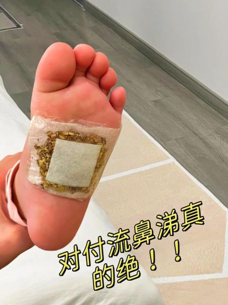 受凉流清鼻涕怎么办_最快缓解方法-第2张图片-山城妙识 受凉流清鼻涕怎么办_最快缓解方法-第2张图片-山城妙识