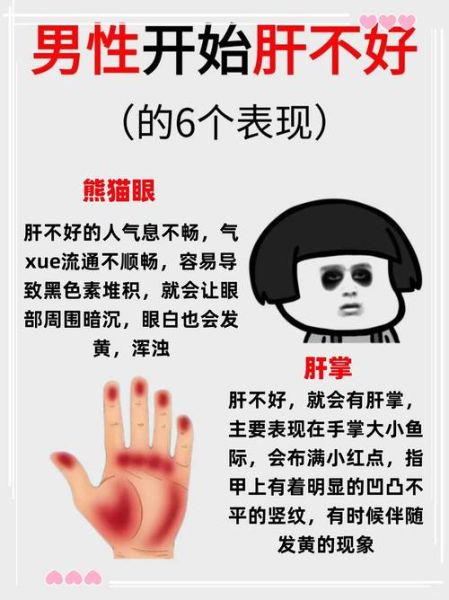 肝脏不好的症状有哪些_肝病早期信号-第3张图片-山城妙识 肝脏不好的症状有哪些_肝病早期信号-第3张图片-山城妙识