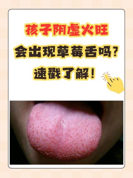 阴虚火旺吃什么食物_阴虚火旺吃什么水果-第2张图片-山城妙识