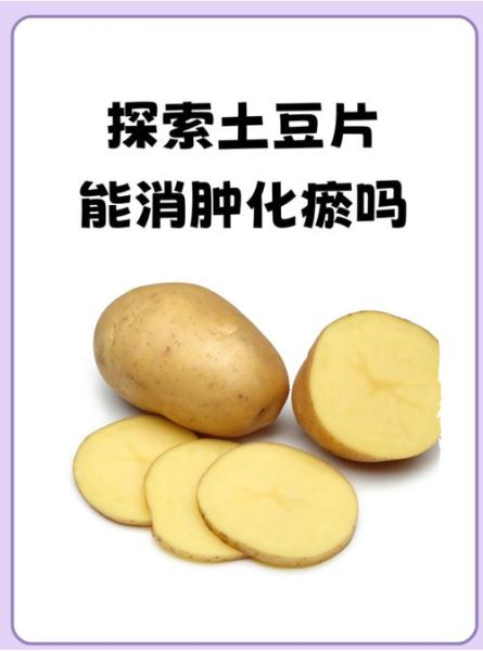 土豆片消肿的正确方法_土豆片敷多久能消肿-第2张图片-山城妙识 土豆片消肿的正确方法_土豆片敷多久能消肿-第2张图片-山城妙识