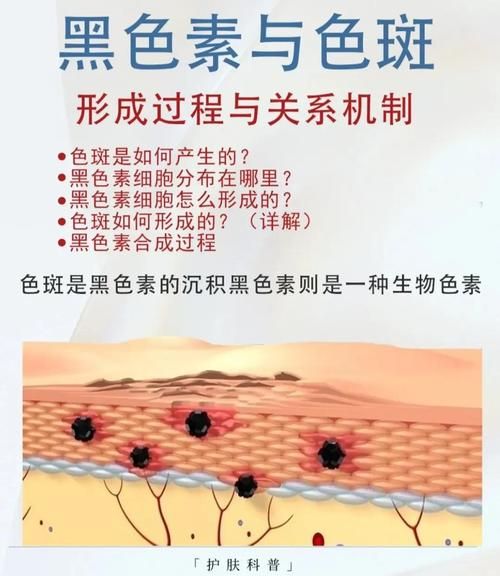 色素沉着能自然恢复吗_多久见效-第2张图片-山城妙识 色素沉着能自然恢复吗_多久见效-第2张图片-山城妙识