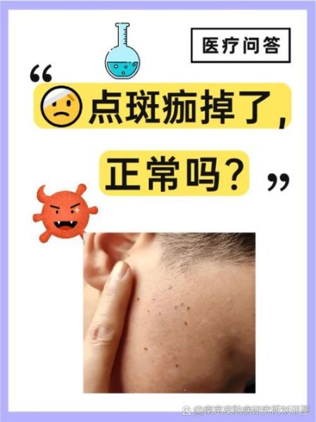 色素沉着能自然恢复吗_多久见效-第1张图片-山城妙识 色素沉着能自然恢复吗_多久见效-第1张图片-山城妙识