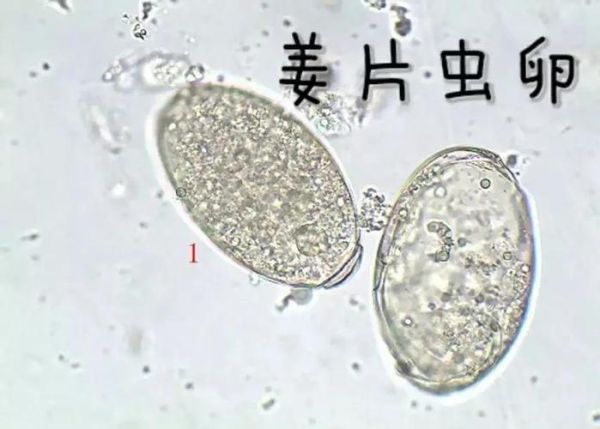 姜片虫如何杀死_姜片虫用什么药最快-第2张图片-山城妙识