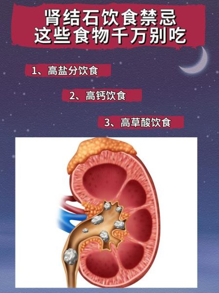 肾结石饮食禁忌_肾结石能吃什么-第3张图片-山城妙识