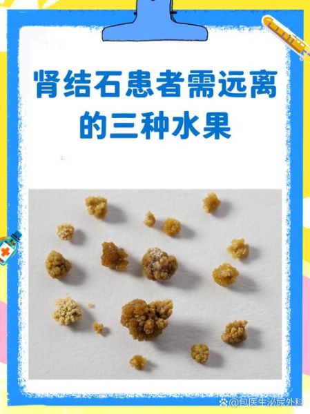 吃什么水果补肾_肾不好能吃哪些水果-第3张图片-山城妙识 吃什么水果补肾_肾不好能吃哪些水果-第3张图片-山城妙识