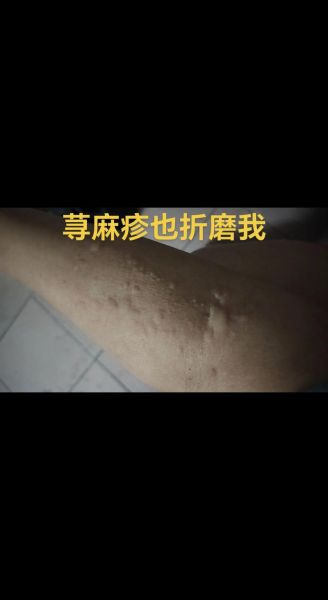 香菜什么人不能吃_香菜过敏症状有哪些-第1张图片-山城妙识 香菜什么人不能吃_香菜过敏症状有哪些-第1张图片-山城妙识
