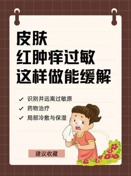 过敏症状有哪些表现_过敏症状怎么快速缓解-第1张图片-山城妙识