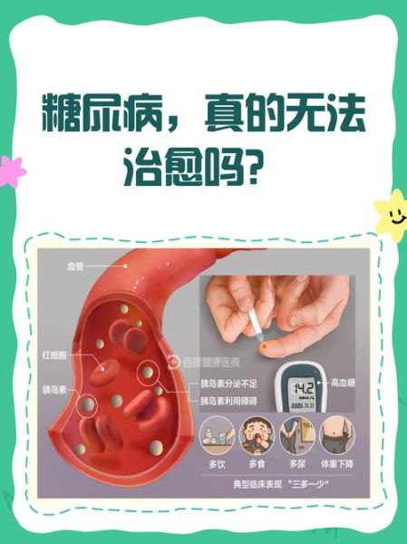 2型糖尿病彻底治愈可能吗_最新突破在哪-第2张图片-山城妙识
