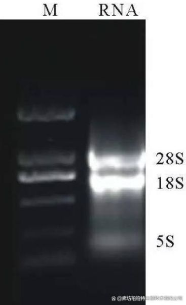 琼脂糖凝胶电泳图怎么看_DNA条带异常原因-第2张图片-山城妙识