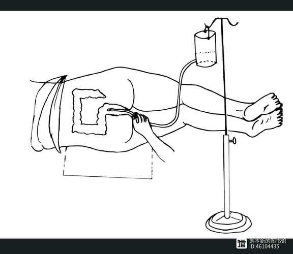 如何在家灌肠_灌肠的正确步骤-第1张图片-山城妙识 如何在家灌肠_灌肠的正确步骤-第1张图片-山城妙识