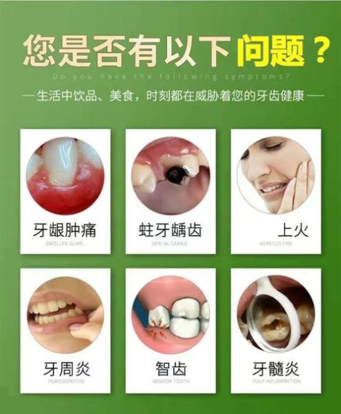 蛀牙牙疼立刻止疼16秒_牙疼怎么快速止疼-第1张图片-山城妙识 蛀牙牙疼立刻止疼16秒_牙疼怎么快速止疼-第1张图片-山城妙识