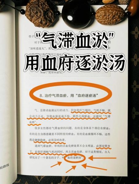 血府逐瘀汤的功效与作用_血府逐瘀汤适合什么人-第1张图片-山城妙识 血府逐瘀汤的功效与作用_血府逐瘀汤适合什么人-第1张图片-山城妙识