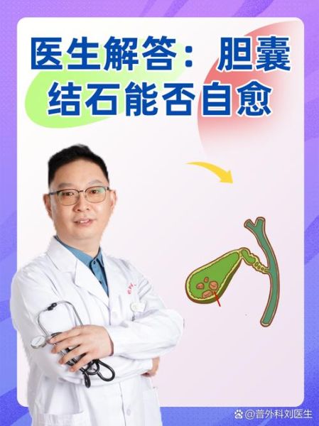 2厘米胆结石自己消失了_胆结石能自愈吗-第1张图片-山城妙识 2厘米胆结石自己消失了_胆结石能自愈吗-第1张图片-山城妙识