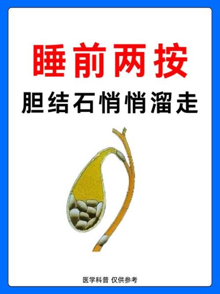 2厘米胆结石自己消失了_胆结石能自愈吗-第3张图片-山城妙识 2厘米胆结石自己消失了_胆结石能自愈吗-第3张图片-山城妙识