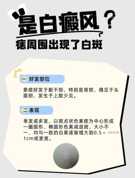 色素减退斑是怎么引起的_能自愈吗-第3张图片-山城妙识