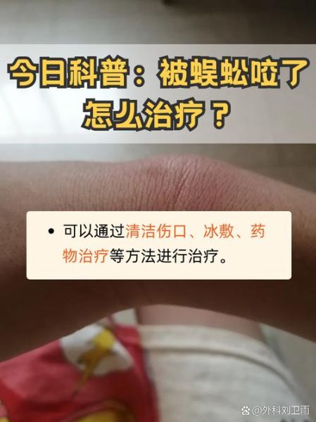 蜈蚣有毒吗_蜈蚣咬了怎么办-第3张图片-山城妙识