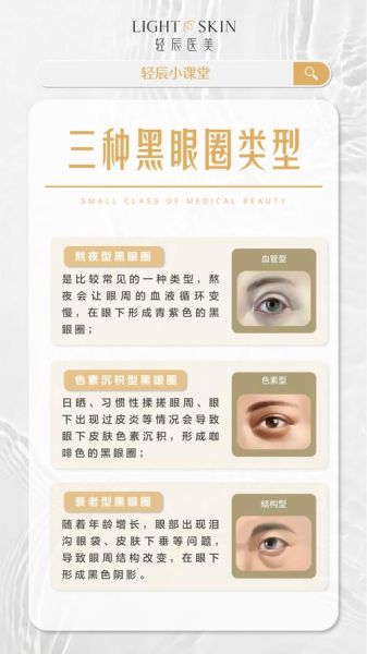 长期黑眼圈是什么原因_黑眼圈暗示哪些疾病-第1张图片-山城妙识