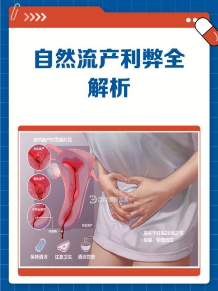 不想人流如何自然流产_自然流产安全吗-第3张图片-山城妙识 不想人流如何自然流产_自然流产安全吗-第3张图片-山城妙识