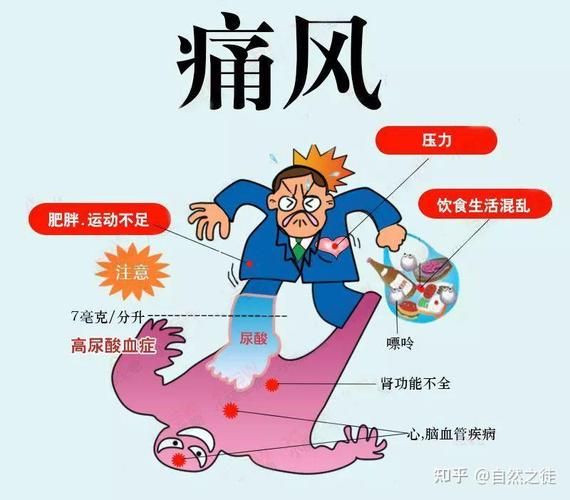 苏打水能缓解痛风吗_痛风喝苏打水有用吗-第2张图片-山城妙识 苏打水能缓解痛风吗_痛风喝苏打水有用吗-第2张图片-山城妙识