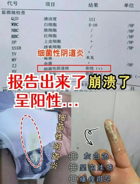 豆腐渣白带一周后自愈_豆腐渣白带能自己好吗-第1张图片-山城妙识 豆腐渣白带一周后自愈_豆腐渣白带能自己好吗-第1张图片-山城妙识