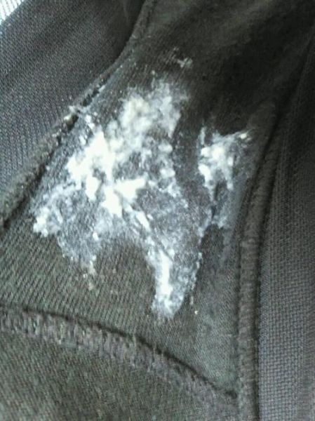 豆腐渣白带一周后自愈_豆腐渣白带能自己好吗-第2张图片-山城妙识 豆腐渣白带一周后自愈_豆腐渣白带能自己好吗-第2张图片-山城妙识