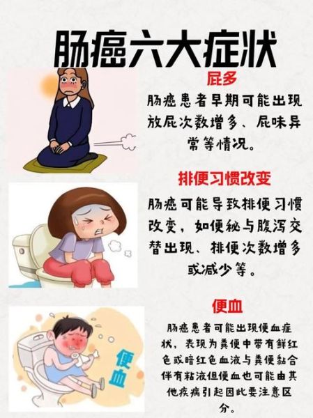 肠癌的早期症状有哪些_肠癌会肚子疼吗-第2张图片-山城妙识