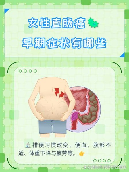 肠癌的早期症状有哪些_肠癌会肚子疼吗-第1张图片-山城妙识
