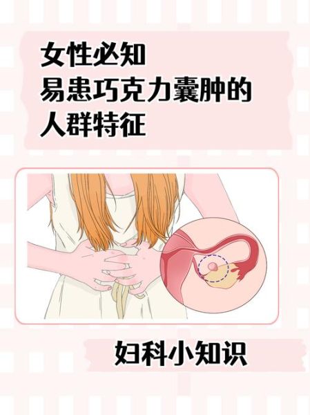 巧克力囊肿症状有哪些_巧克力囊肿会癌变吗-第2张图片-山城妙识