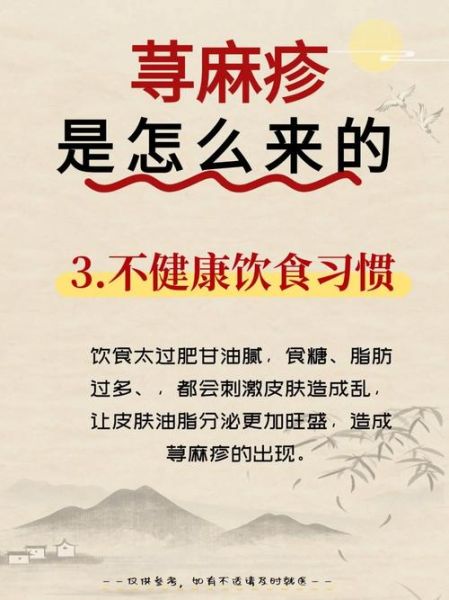 荨麻疹是毒素还是湿气_中医西医怎么看-第1张图片-山城妙识 荨麻疹是毒素还是湿气_中医西医怎么看-第1张图片-山城妙识