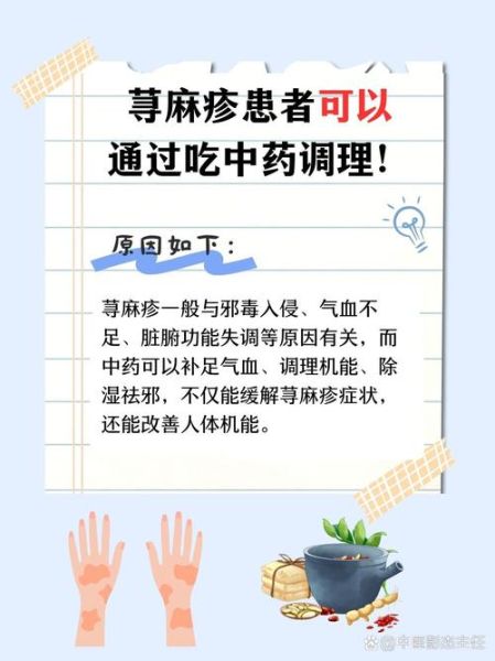 荨麻疹是毒素还是湿气_中医西医怎么看-第3张图片-山城妙识 荨麻疹是毒素还是湿气_中医西医怎么看-第3张图片-山城妙识