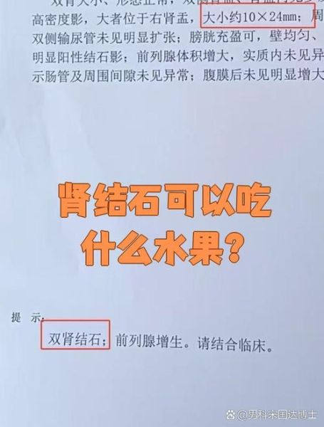 肾结石不能吃什么水果_肾结石禁忌水果有哪些-第2张图片-山城妙识