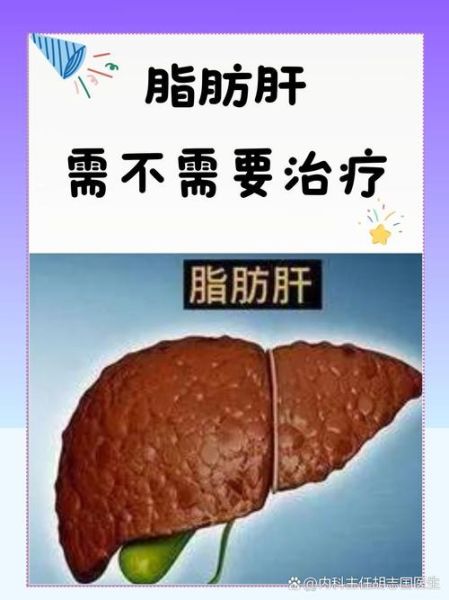 轻度脂肪肝怎么减_轻度脂肪肝多久能恢复-第3张图片-山城妙识 轻度脂肪肝怎么减_轻度脂肪肝多久能恢复-第3张图片-山城妙识