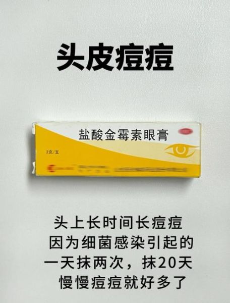 脱发严重怎么治疗才有效_脱发严重用什么药最好-第1张图片-山城妙识 脱发严重怎么治疗才有效_脱发严重用什么药最好-第1张图片-山城妙识