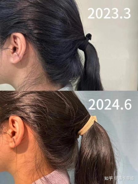 脱发严重怎么治疗才有效_脱发严重用什么药最好-第3张图片-山城妙识 脱发严重怎么治疗才有效_脱发严重用什么药最好-第3张图片-山城妙识