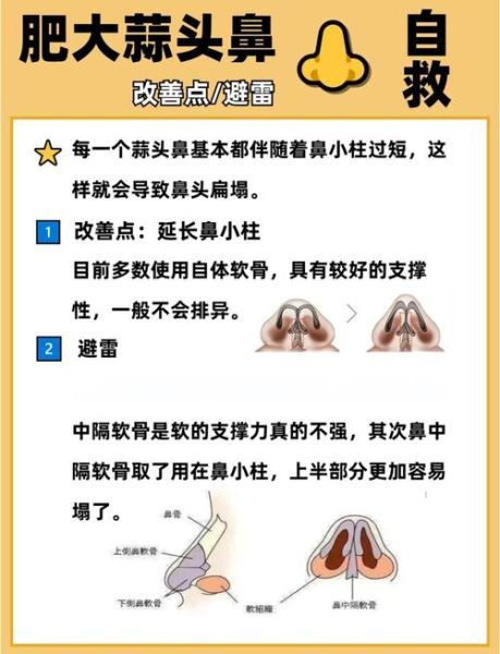 大蒜鼻怎么办_大蒜鼻怎么改善-第1张图片-山城妙识 大蒜鼻怎么办_大蒜鼻怎么改善-第1张图片-山城妙识