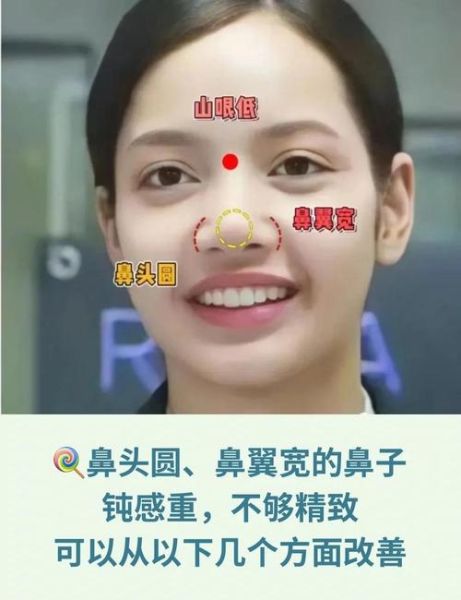 大蒜鼻怎么办_大蒜鼻怎么改善-第3张图片-山城妙识 大蒜鼻怎么办_大蒜鼻怎么改善-第3张图片-山城妙识