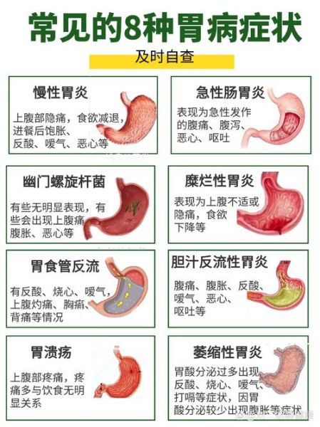 胃癌早期有哪些症状_胃癌的三个信号是什么-第1张图片-山城妙识