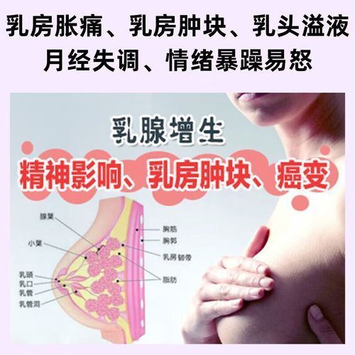 乳腺增生结节怎么消除_乳腺增生结节吃什么药-第2张图片-山城妙识