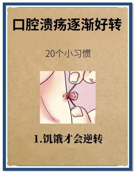 口腔溃疡10秒治愈方法_真的有用吗-第1张图片-山城妙识
