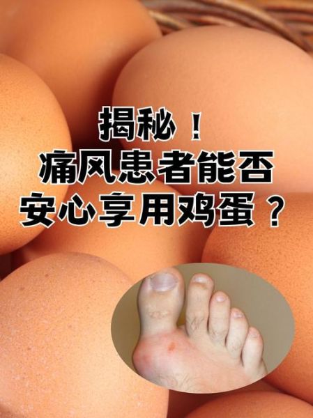 痛风能吃鸡蛋吗_痛风一天可以吃几个鸡蛋-第2张图片-山城妙识