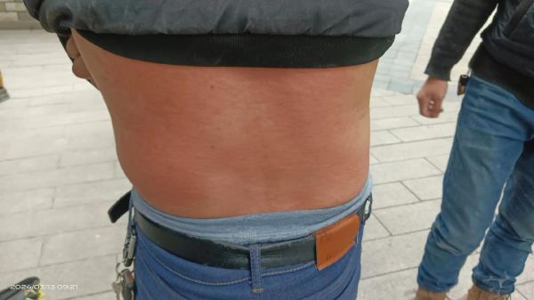 什么病不能吃鹅肉_鹅肉过敏症状有哪些-第1张图片-山城妙识