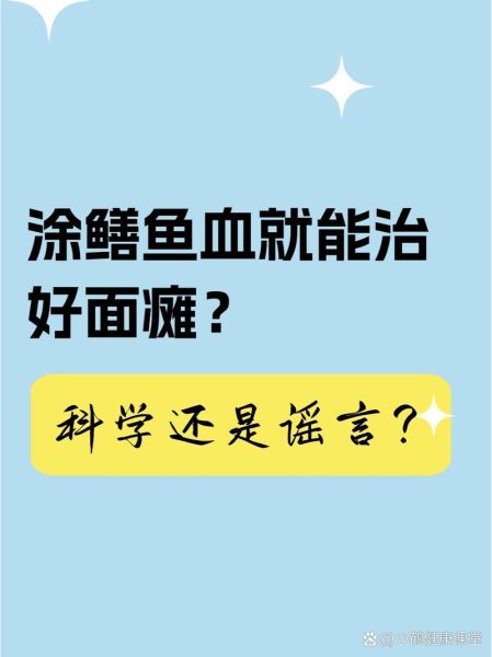 黄鳝血能治面瘫吗_黄鳝血治疗面瘫偏方真相-第3张图片-山城妙识