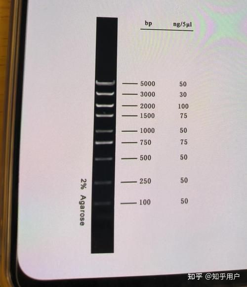 琼脂糖凝胶电泳结果图怎么看_条带模糊原因-第1张图片-山城妙识 琼脂糖凝胶电泳结果图怎么看_条带模糊原因-第1张图片-山城妙识