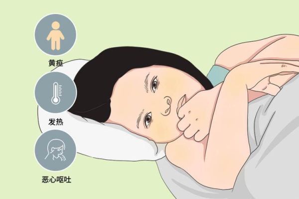 蚕豆病发作有哪些症状_蚕豆病急性溶血表现-第3张图片-山城妙识