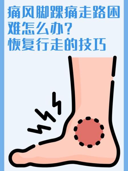 脚痛风最快的恢复办法_痛风发作如何快速止痛-第3张图片-山城妙识