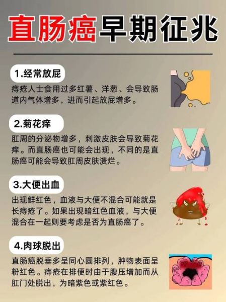 肠癌早期一天几次大便_肠癌早期排便次数变化-第3张图片-山城妙识